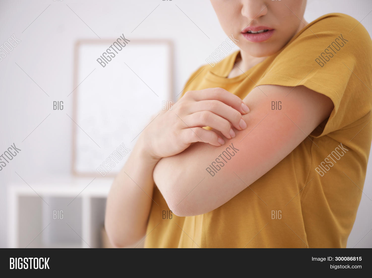 Woman Scratching Arm Image & Photo (Free Trial) | Bigstock