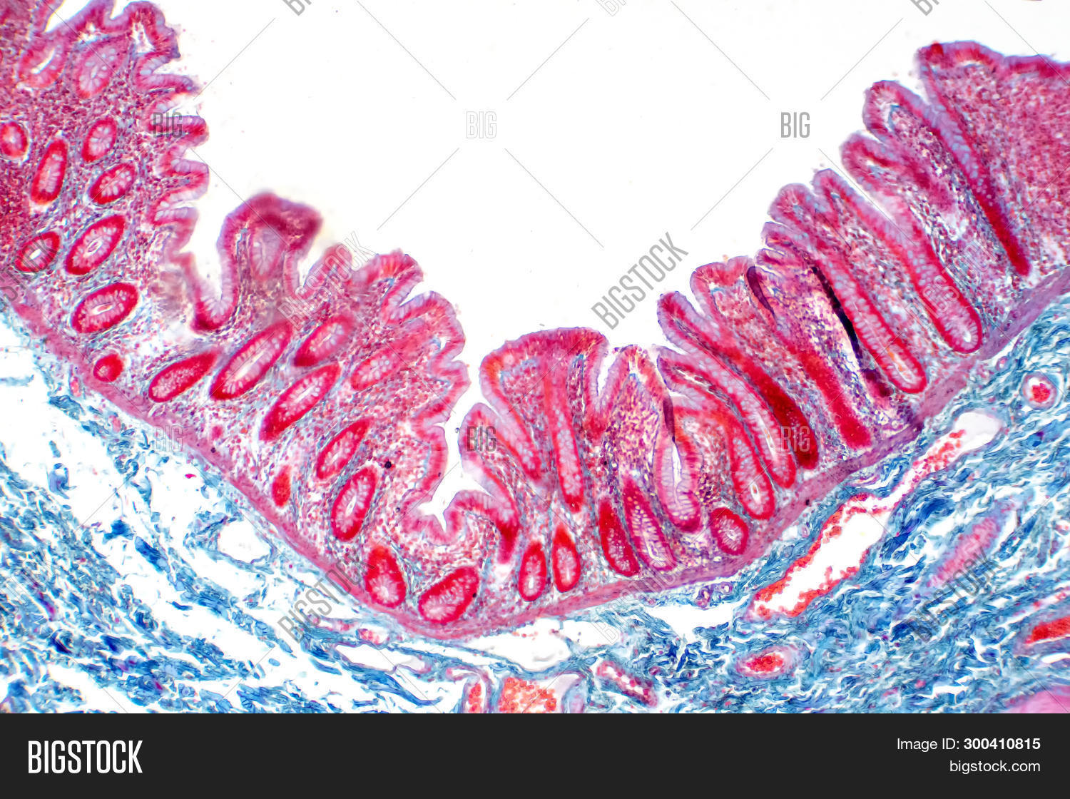 Human Large Intestine Image & Photo (Free Trial) | Bigstock