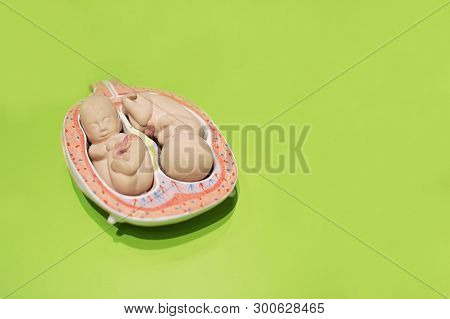 Twins Embryo Model. Image & Photo (Free Trial) | Bigstock