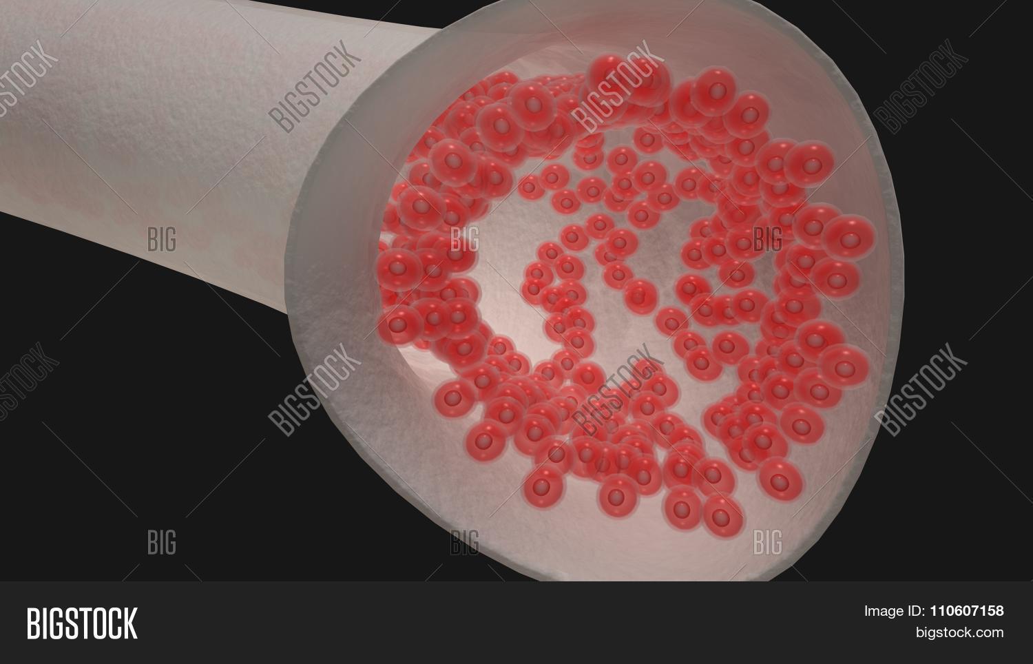 Endoscopic View Image & Photo (Free Trial) | Bigstock