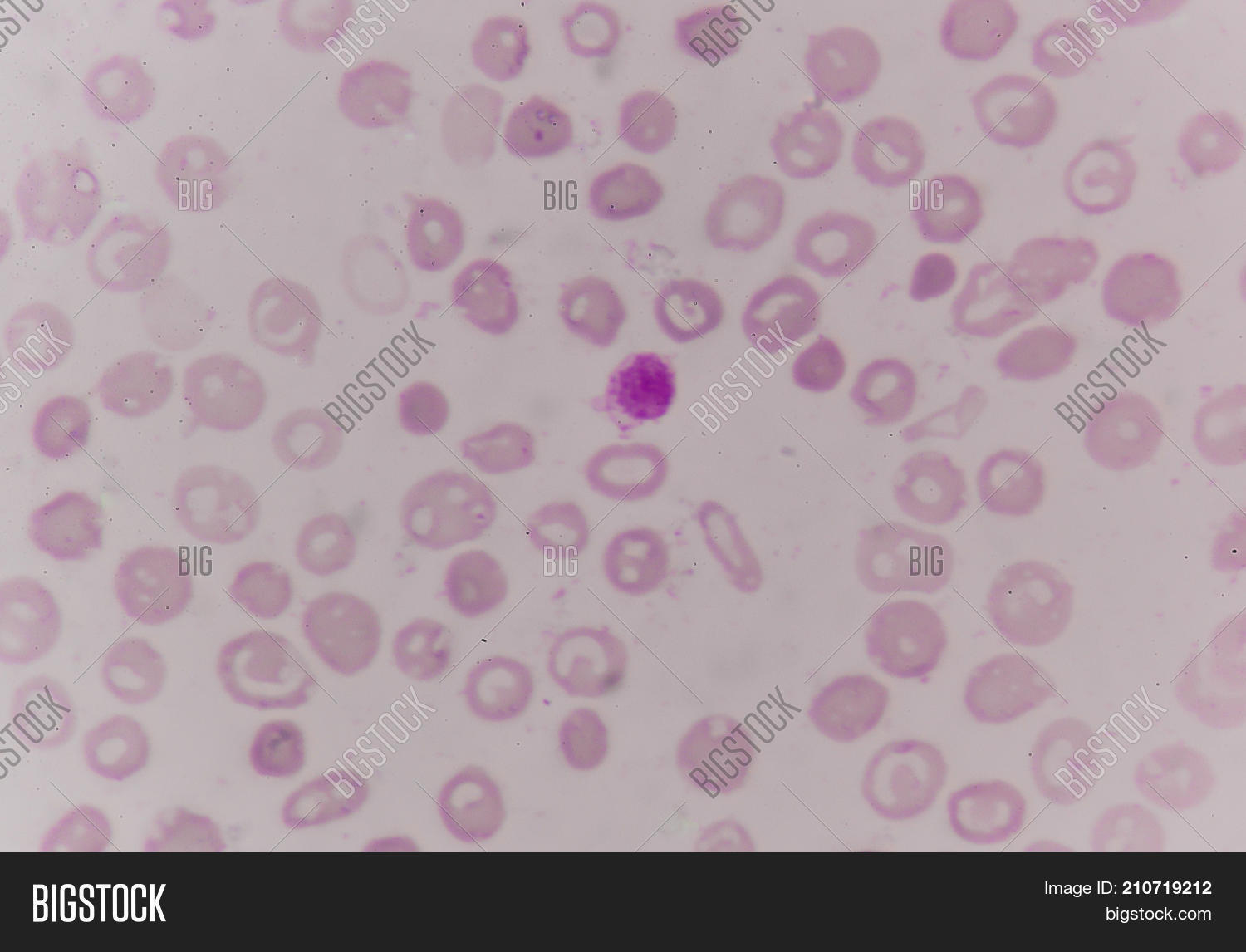 Giant Platelet On Red Image & Photo (Free Trial) | Bigstock