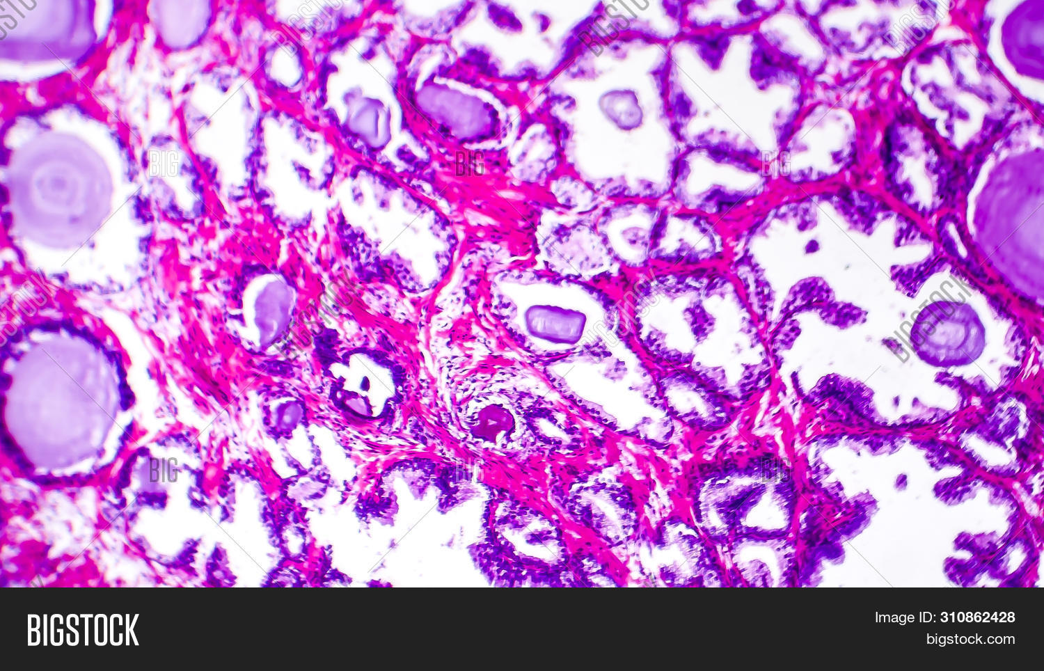 Histopathology Image & Photo (Free Trial) | Bigstock