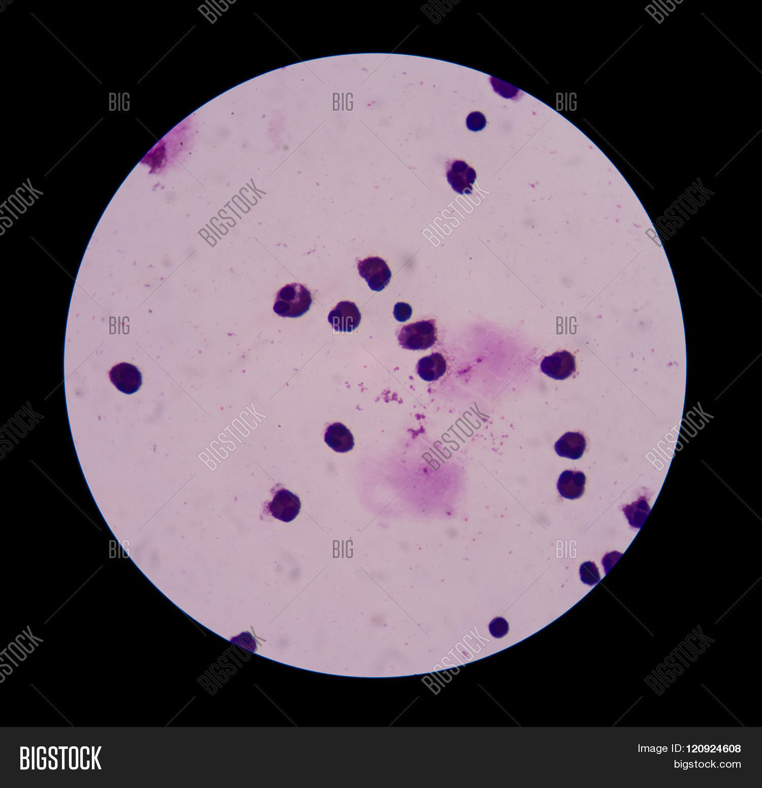 Blood Smear Often Used Image & Photo (Free Trial) | Bigstock