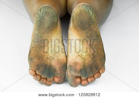 Dirty Foot Cracked Image & Photo (Free Trial) | Bigstock