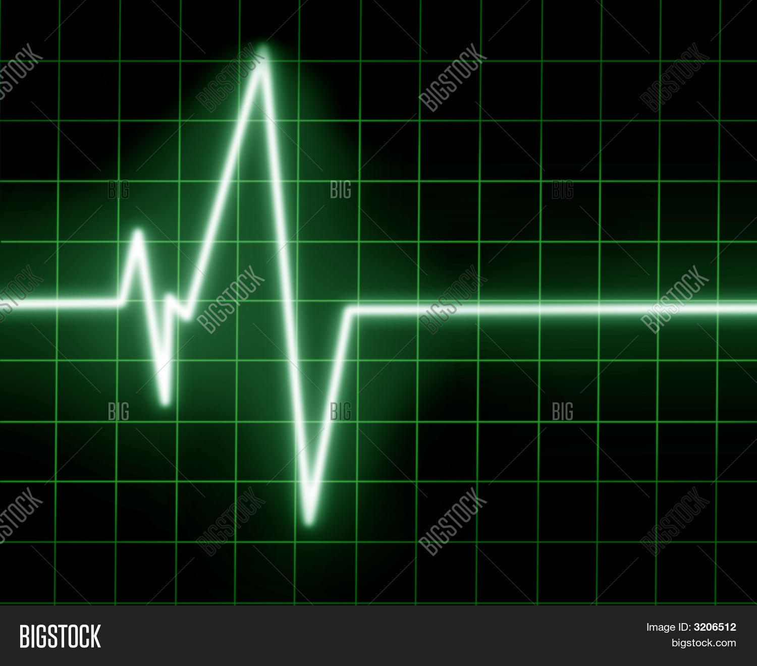 Heart Monitor Image & Photo (Free Trial) | Bigstock