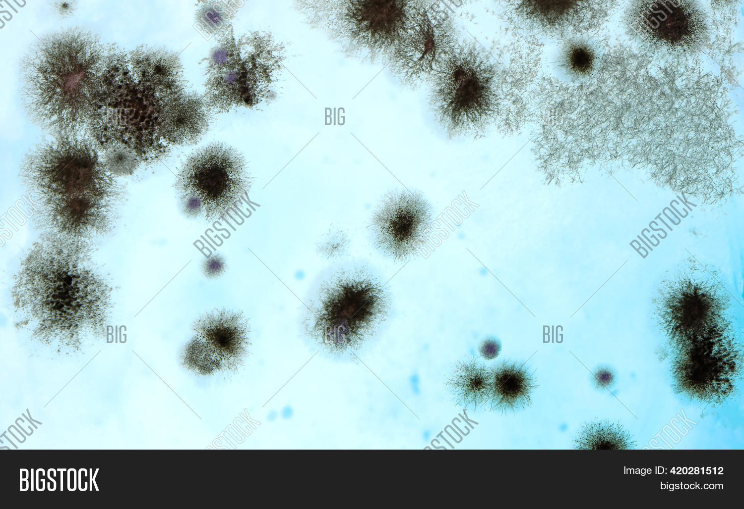 Fungal Spores Liquid Image And Photo Free Trial Bigstock