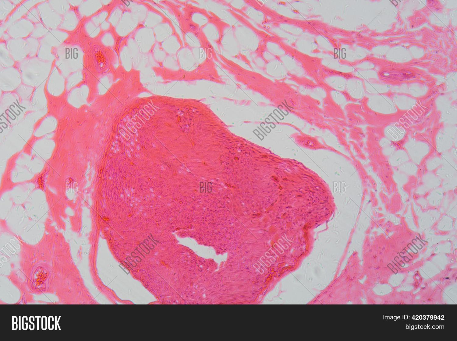 Cross Section Human Image & Photo (Free Trial) | Bigstock