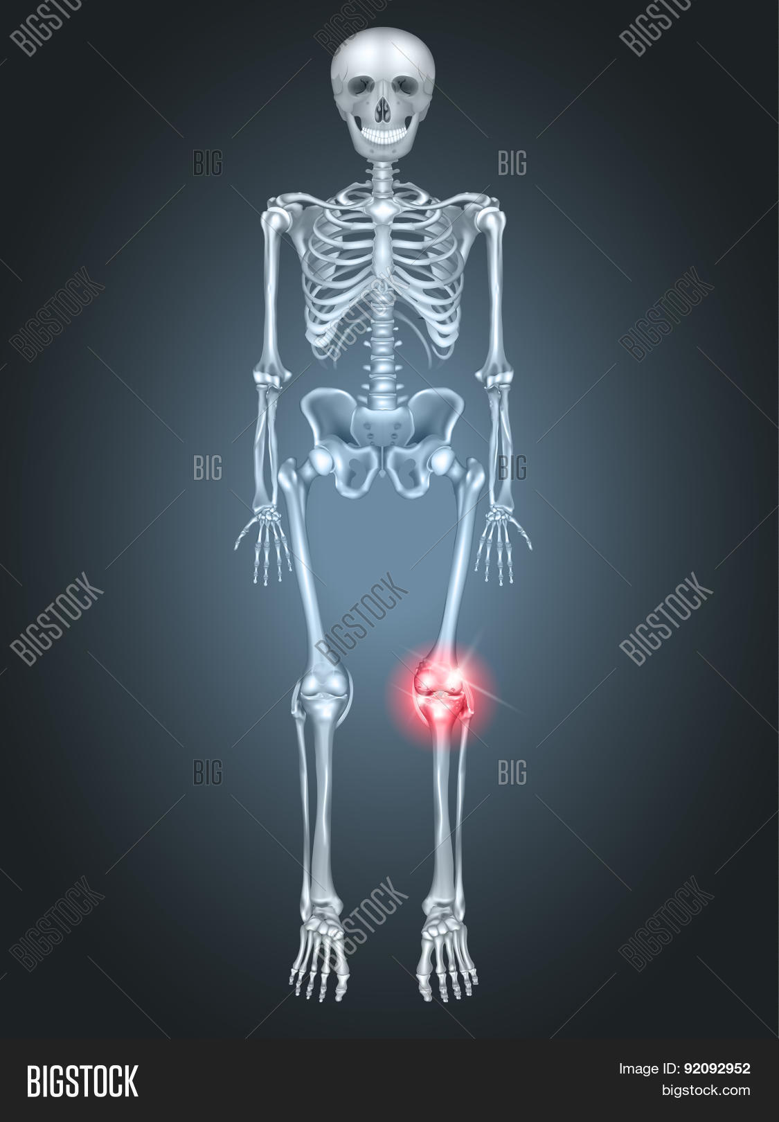 Skeleton Knee Joint Vector & Photo (Free Trial) | Bigstock