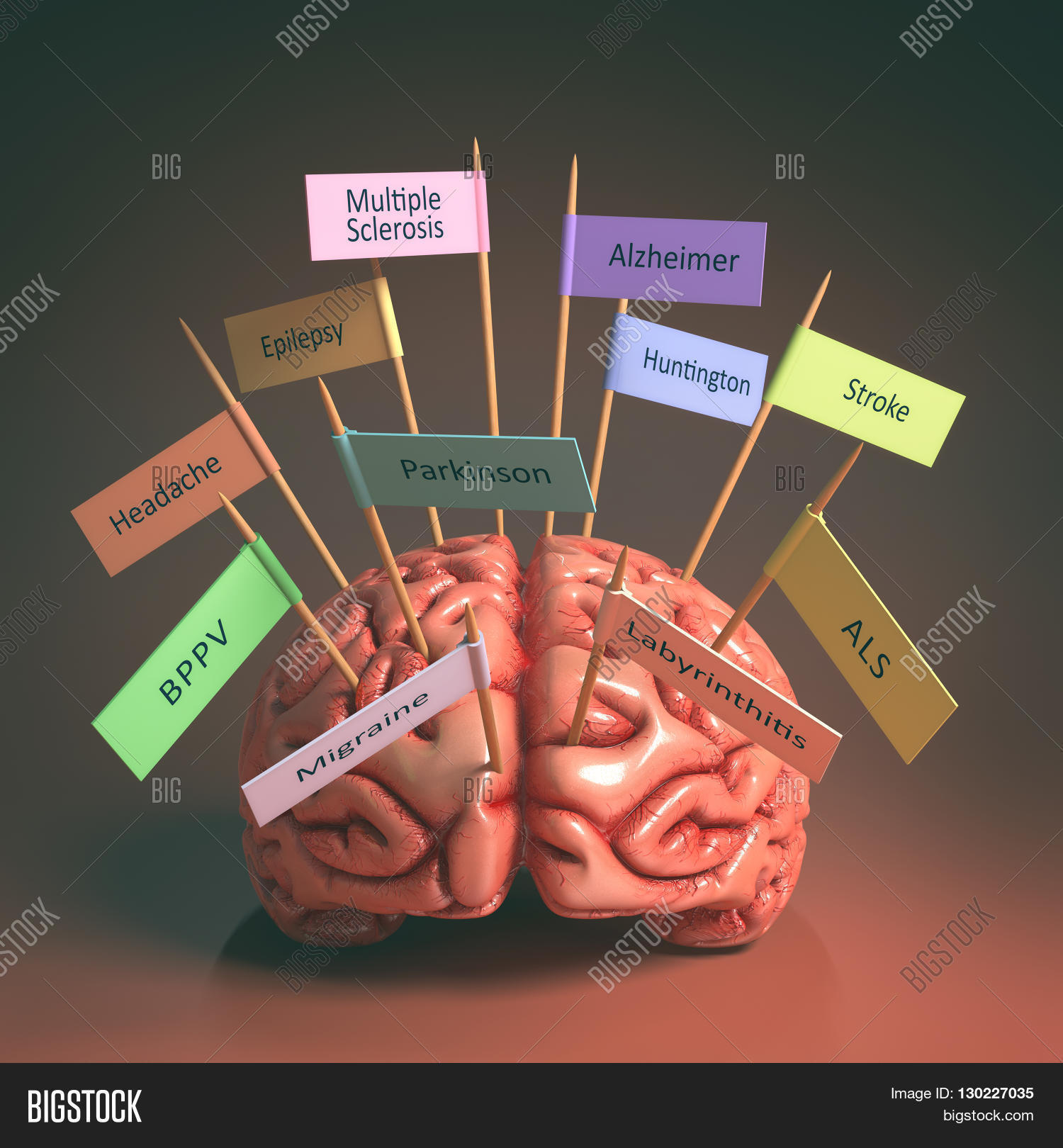 Image Brain On Table Image & Photo (Free Trial) | Bigstock