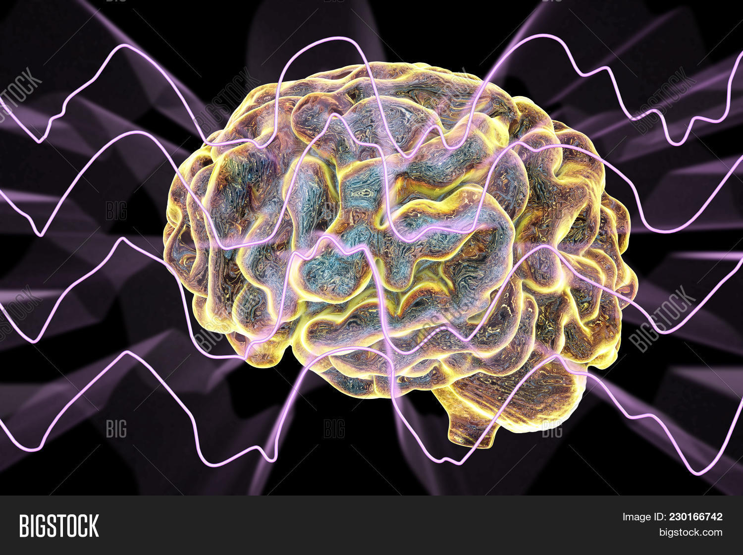 Eeg Image & Photo (Free Trial) | Bigstock