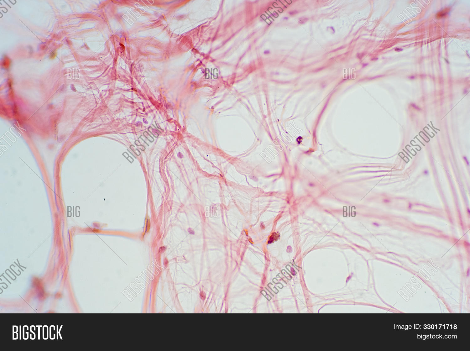 Areolar Connective Image & Photo (Free Trial) | Bigstock