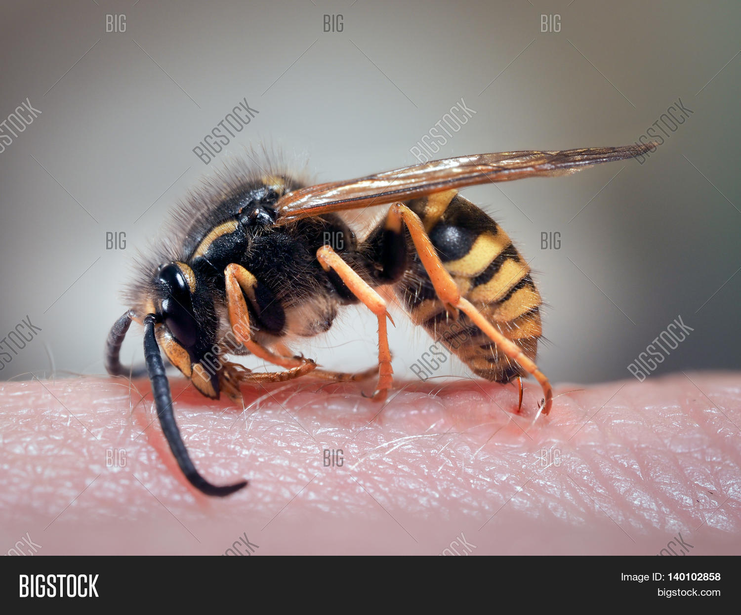 Wasp On Human Hand. Image & Photo (Free Trial) | Bigstock