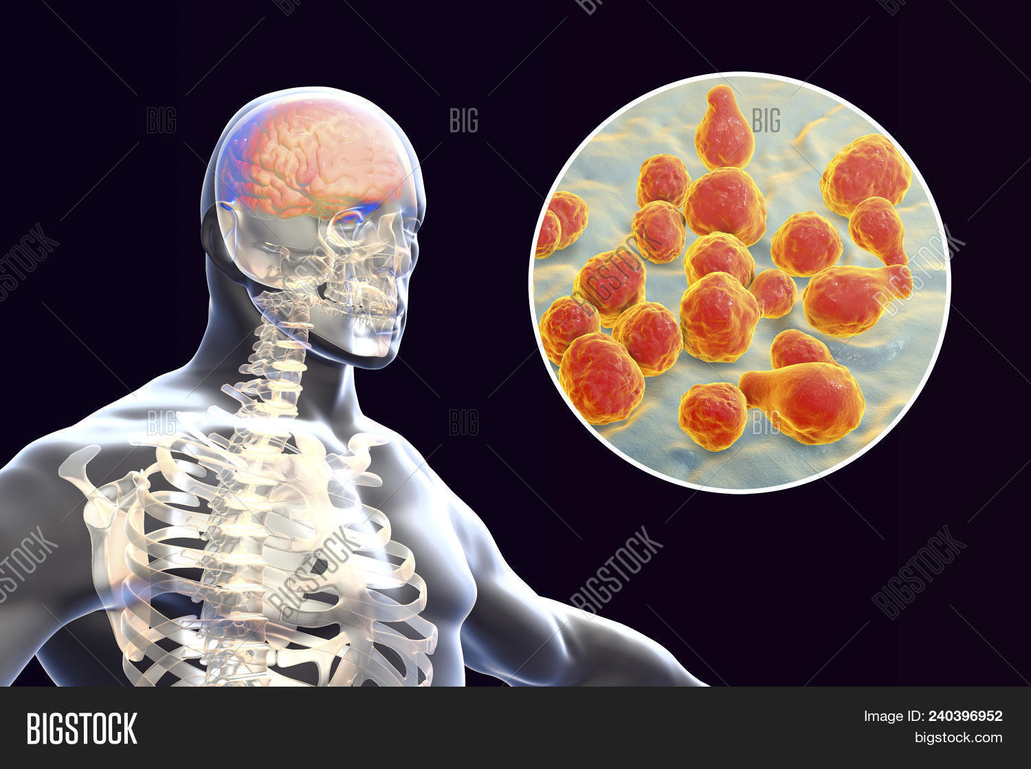 Cryptococcal Image & Photo (Free Trial) | Bigstock