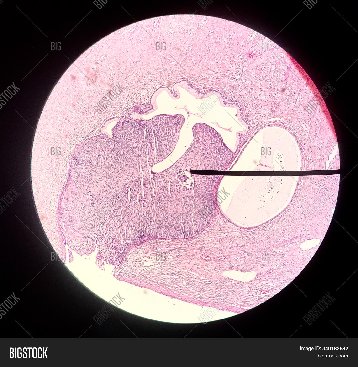 Cells Reproductive Image & Photo (Free Trial) | Bigstock