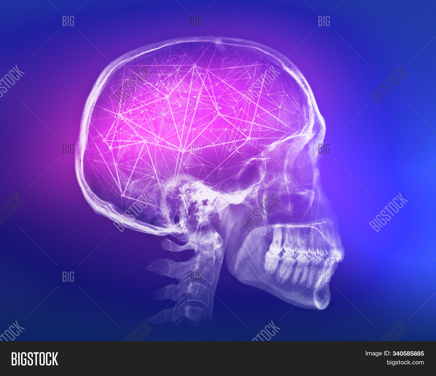 Human Skull X Ray Image And Photo Free Trial Bigstock