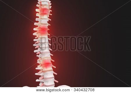 Realistic Skeletal Image & Photo (Free Trial) | Bigstock