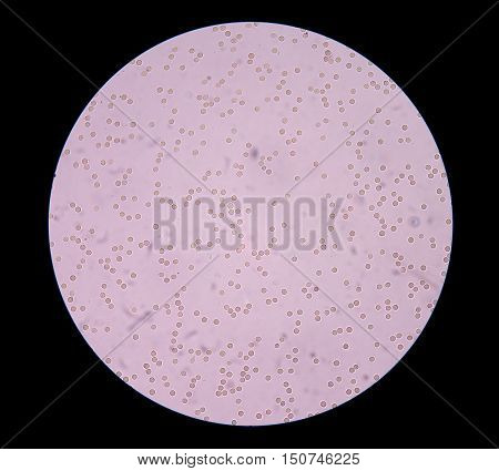 Normal Red Blood Cells Image & Photo (Free Trial) | Bigstock