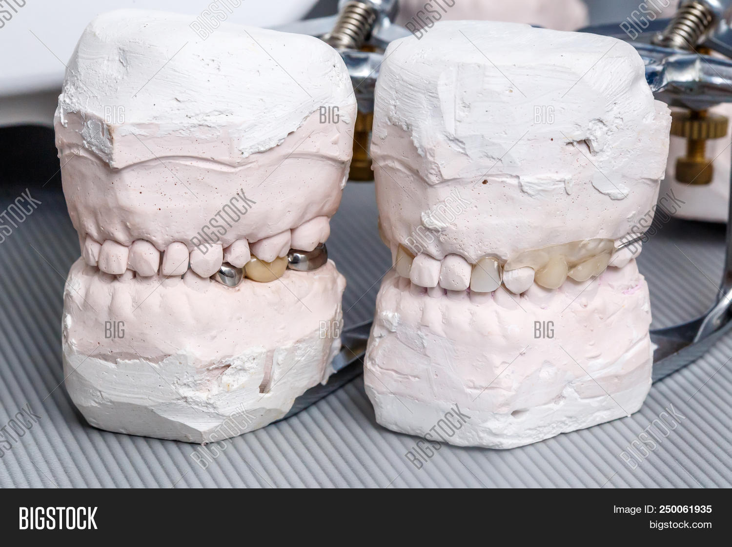 Gray Dental Prosthesis Image & Photo (Free Trial) | Bigstock