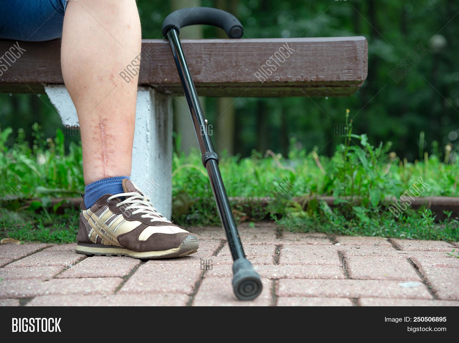 Scared Leg Disabled Image & Photo (Free Trial) | Bigstock