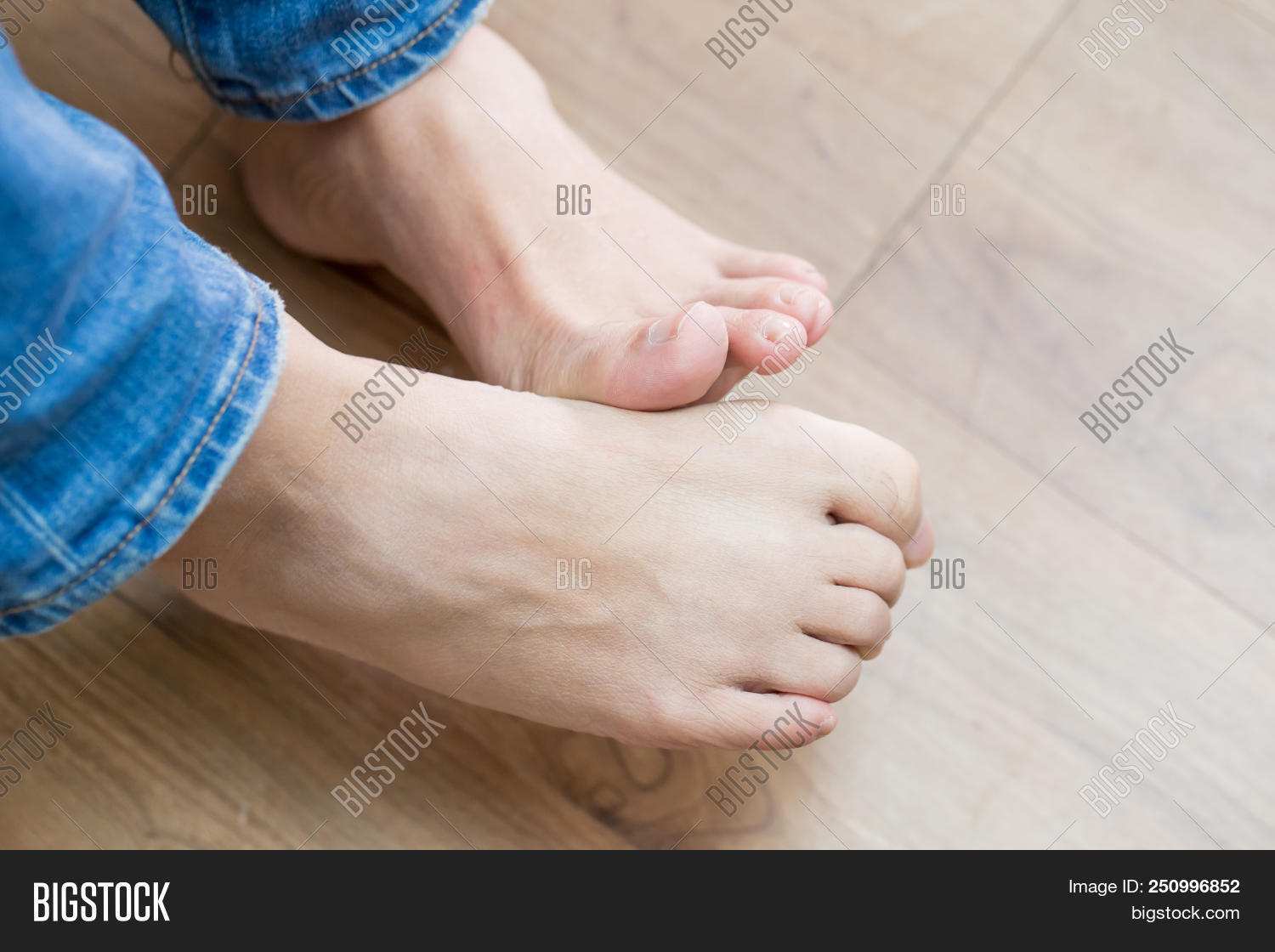 Close Man Athlete Foot Image & Photo (Free Trial) | Bigstock