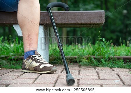 Scared Leg Disabled Image & Photo (Free Trial) | Bigstock