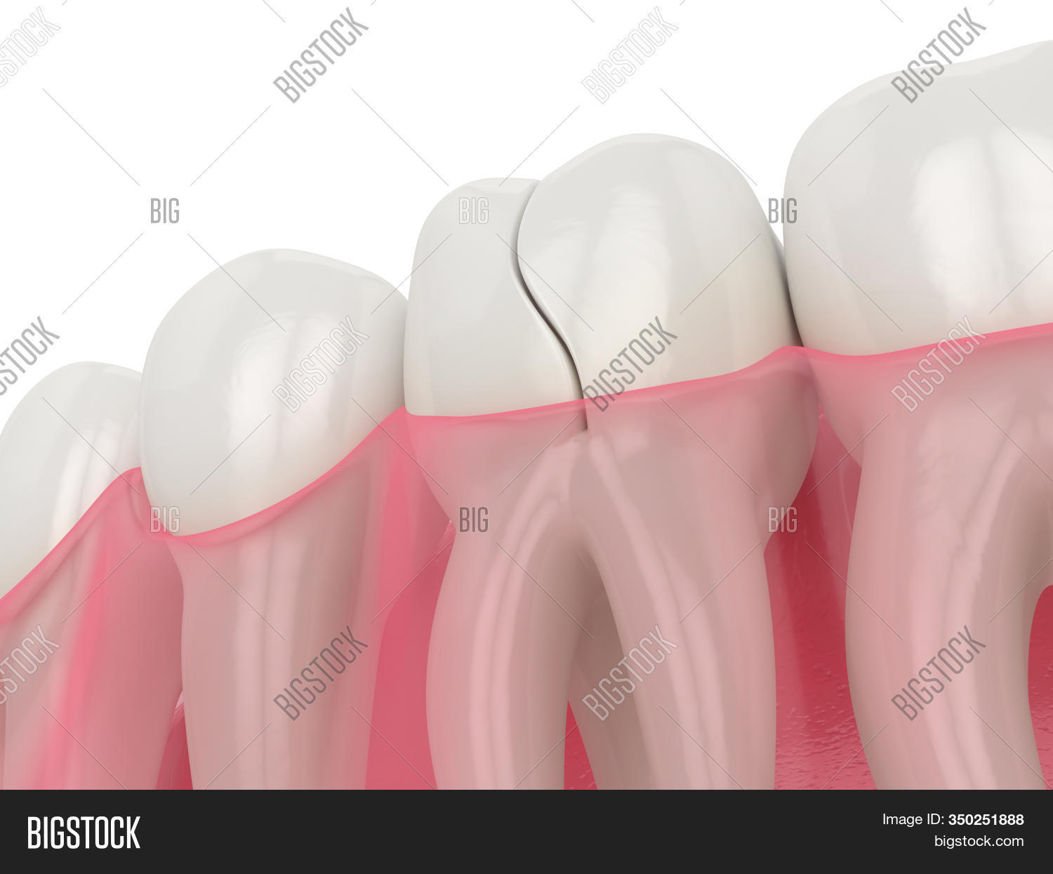 3d Render Jaw Image & Photo (Free Trial) | Bigstock