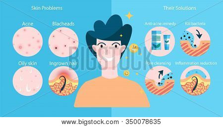 Young Man Bad Skin Vector & Photo (Free Trial) | Bigstock