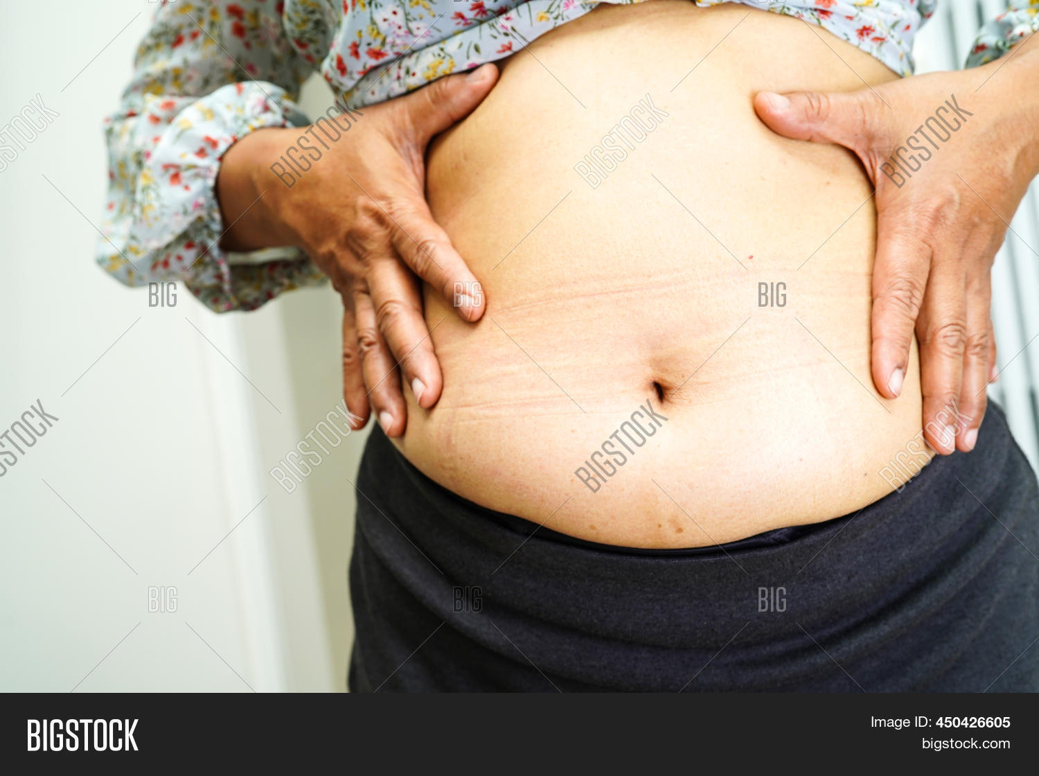 Overweight Asian Woman Image And Photo Free Trial Bigstock