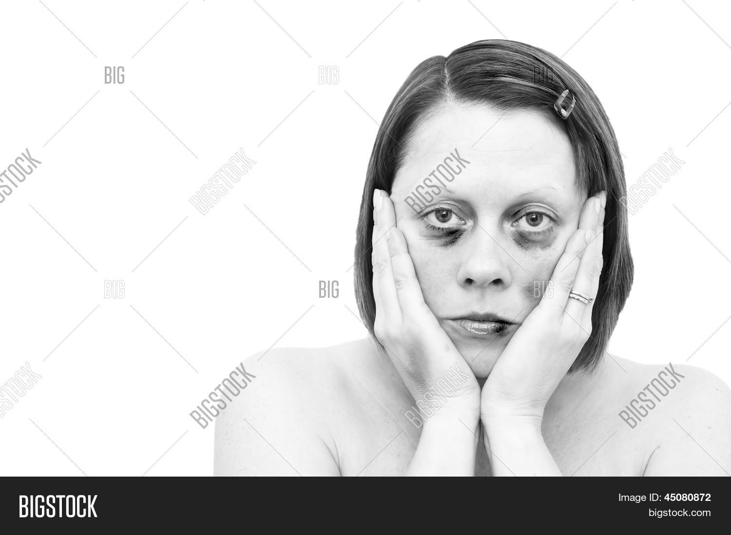 Female Victim Assault Image & Photo (Free Trial) | Bigstock
