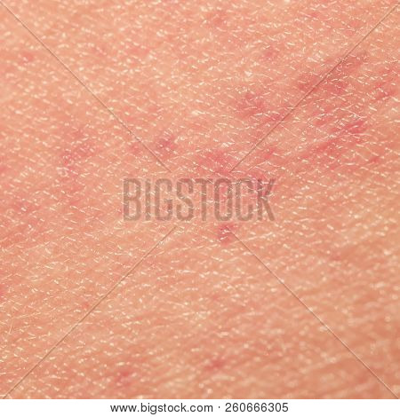 Sick Human Skin Image & Photo (Free Trial) | Bigstock
