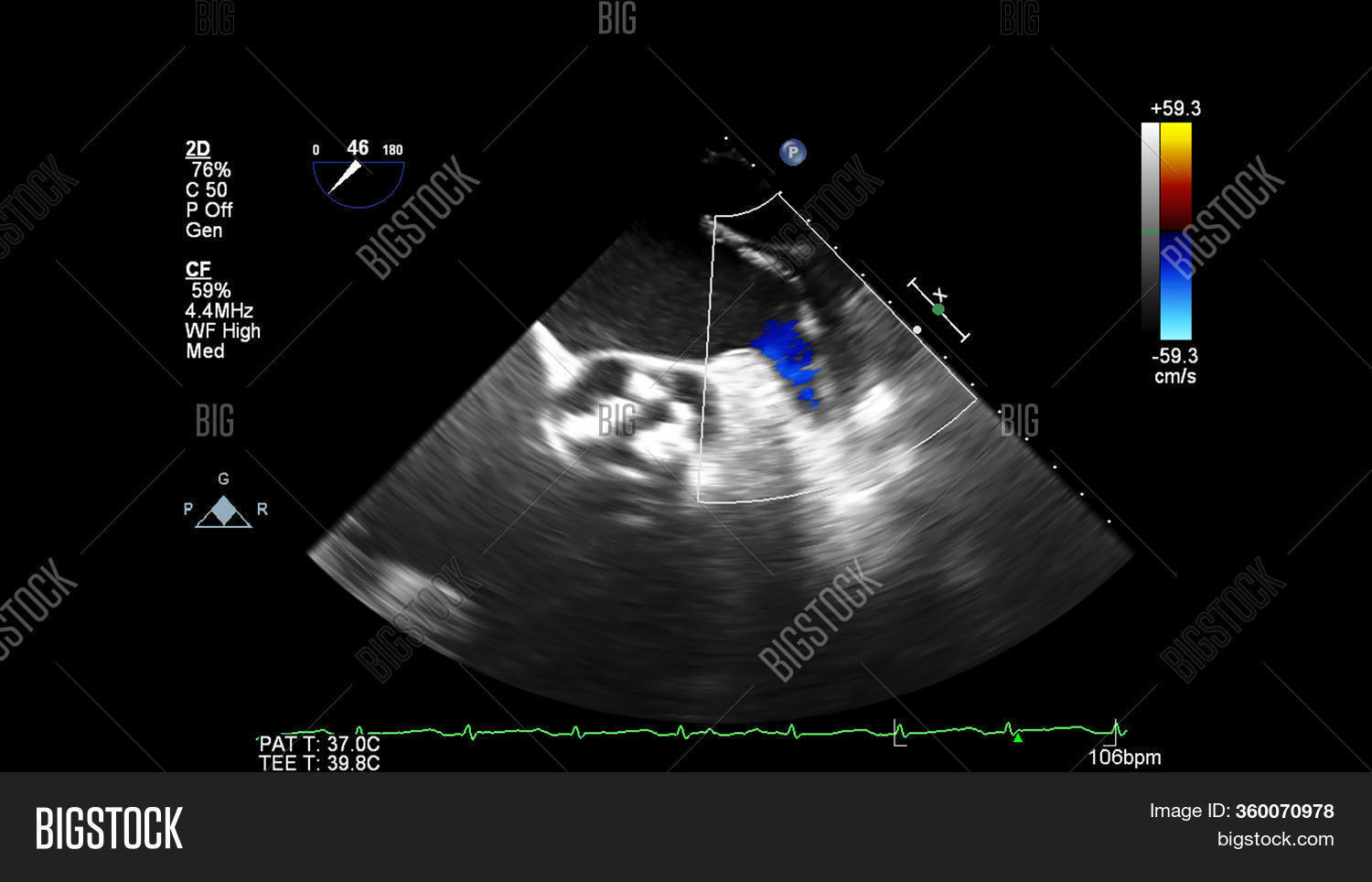 Image Heart Gray-scale Image & Photo (Free Trial) | Bigstock