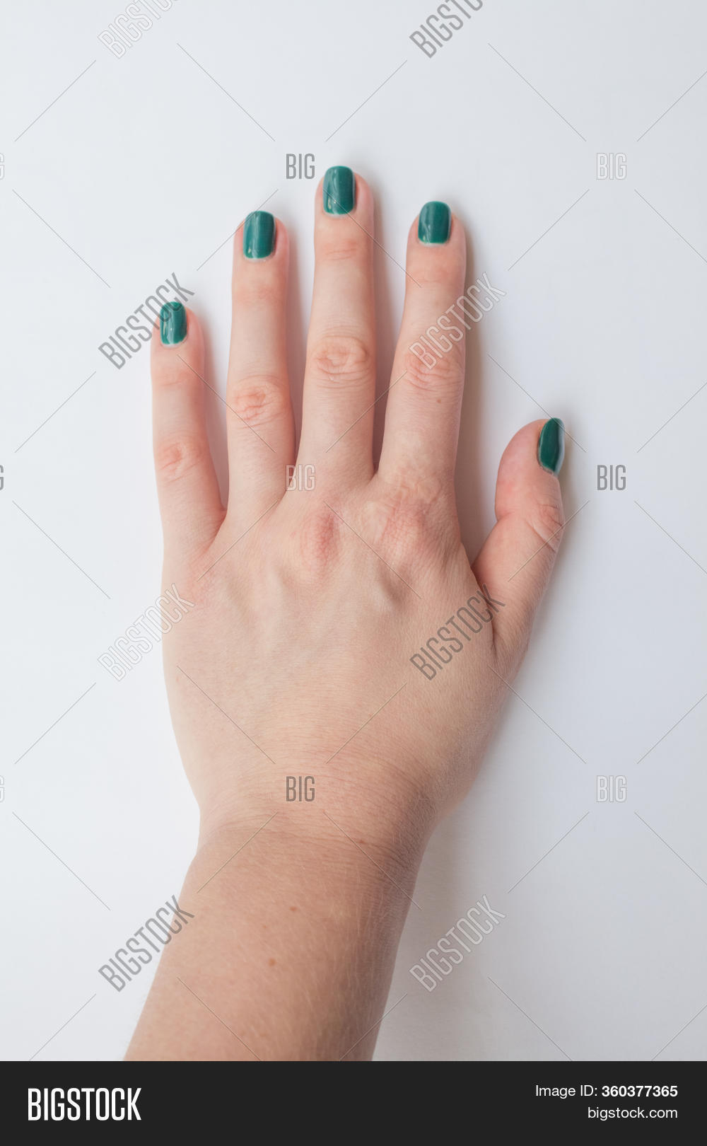 Scar On Finger Man On Image & Photo (Free Trial) | Bigstock