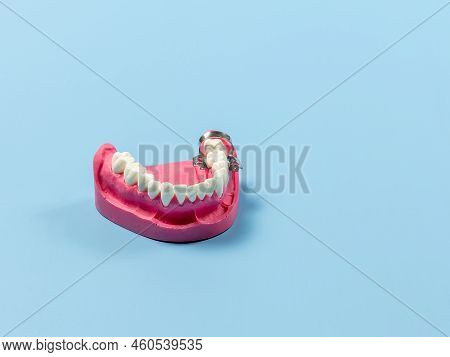 Layout Human Jaw Clamp Image & Photo (Free Trial) | Bigstock