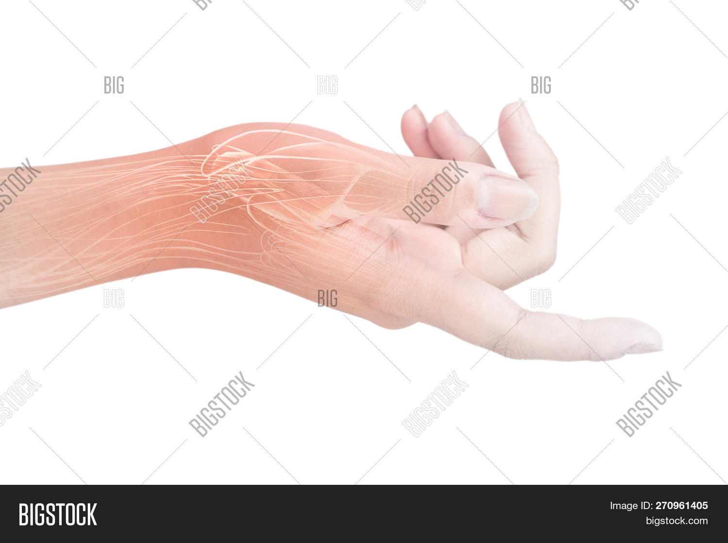 Wrist Muscle Injury Image & Photo (Free Trial) | Bigstock