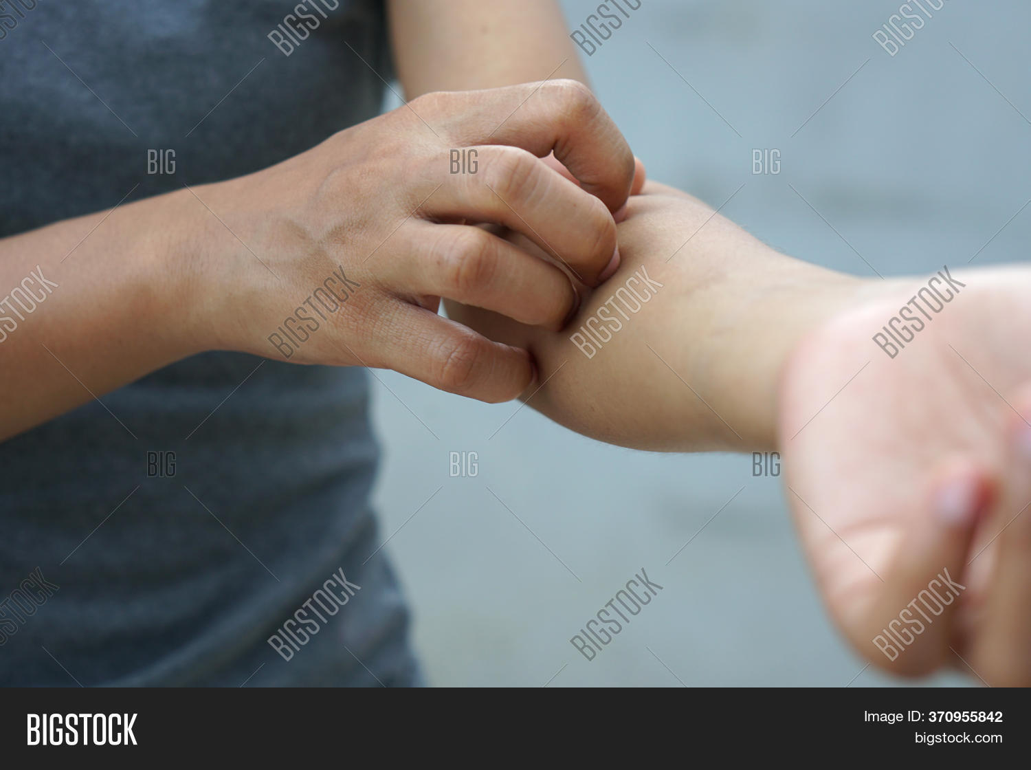 Woman Scratching Arm Image & Photo (Free Trial) | Bigstock