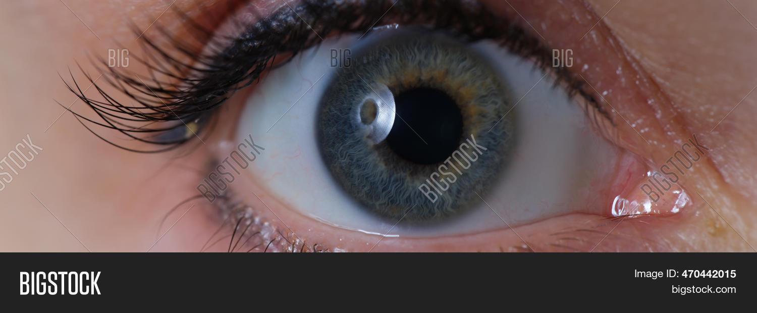 Wide Open Female Eye Image & Photo (Free Trial) | Bigstock