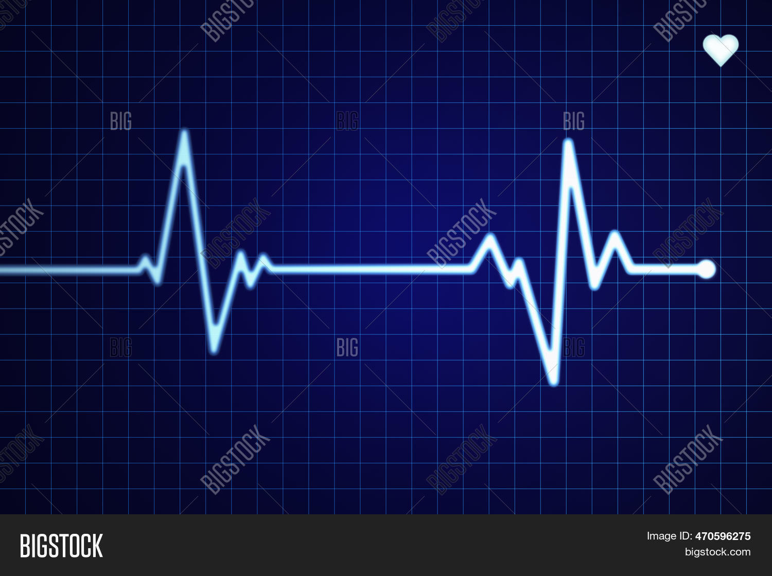 Electrocardiogram - Image & Photo (Free Trial) | Bigstock