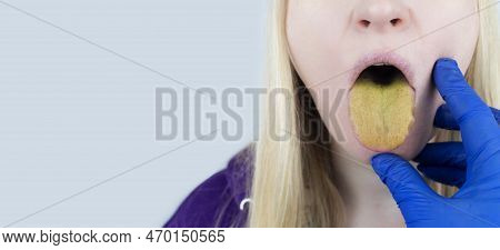 Woman Has Yellow Image & Photo (Free Trial) | Bigstock
