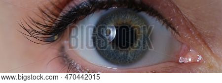 Wide Open Female Eye Image & Photo (Free Trial) | Bigstock