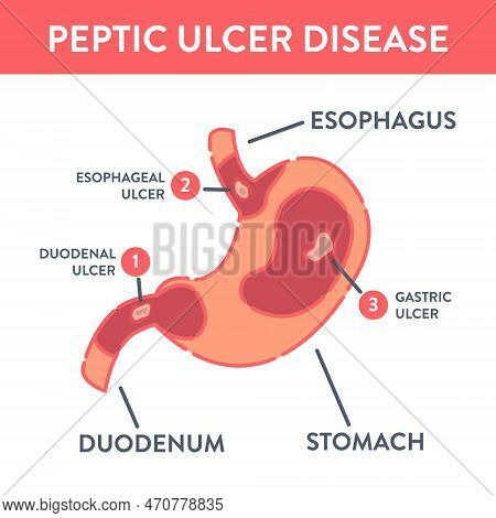 Medical Infographics Vector & Photo (Free Trial) | Bigstock