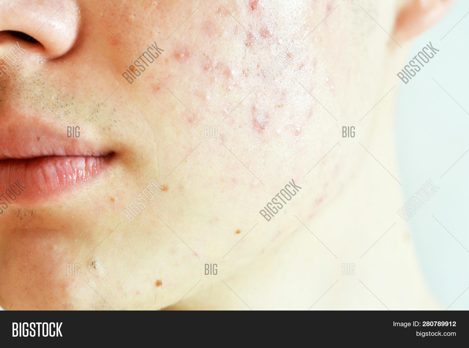 Close Man Problematic Image & Photo (Free Trial) | Bigstock