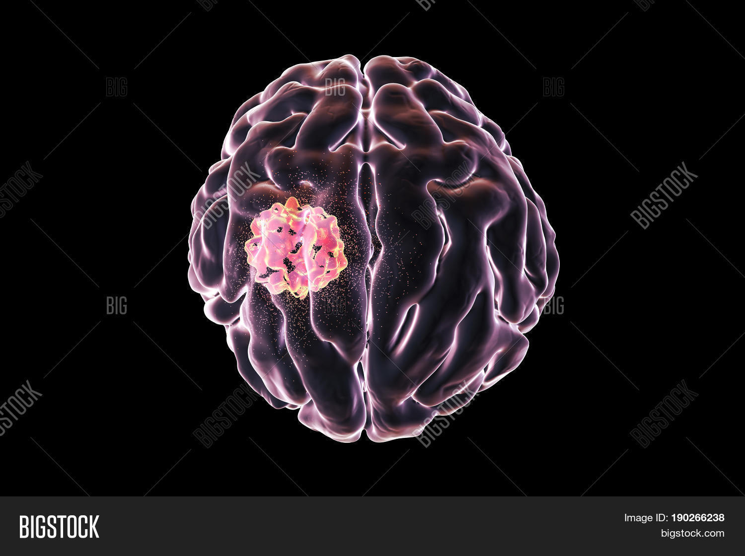 Destruction Brain Image & Photo (Free Trial) | Bigstock