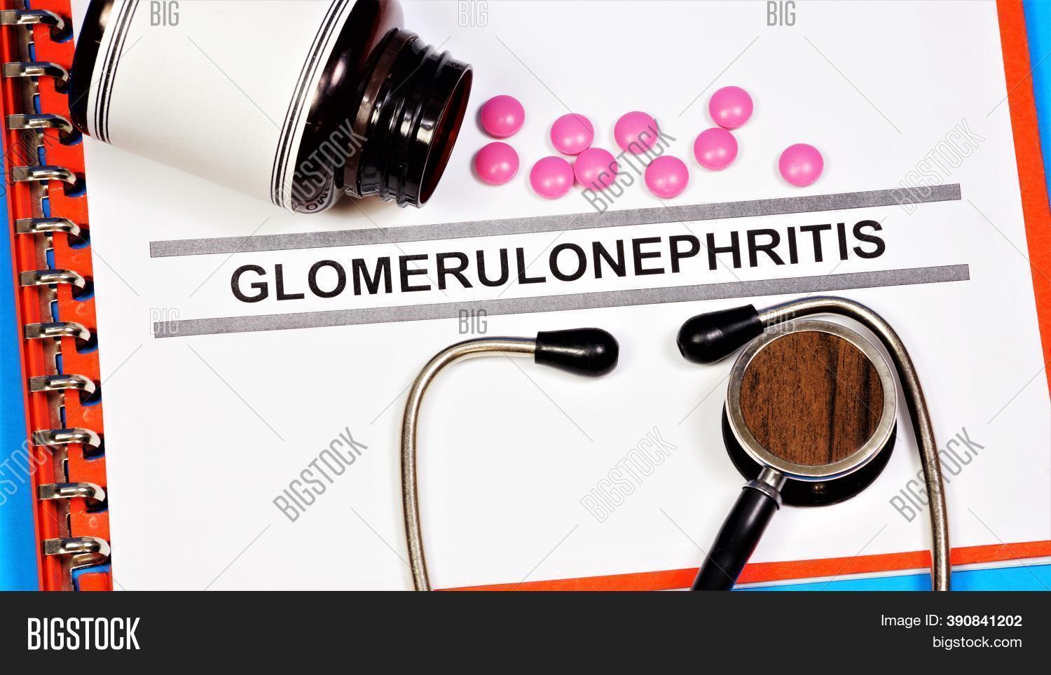 Glomerulonephritis. Image & Photo (Free Trial) | Bigstock