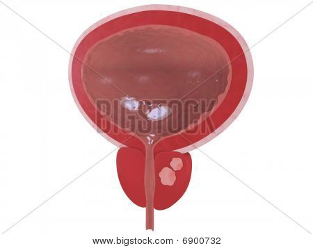 Human Bladder Image & Photo (Free Trial) | Bigstock