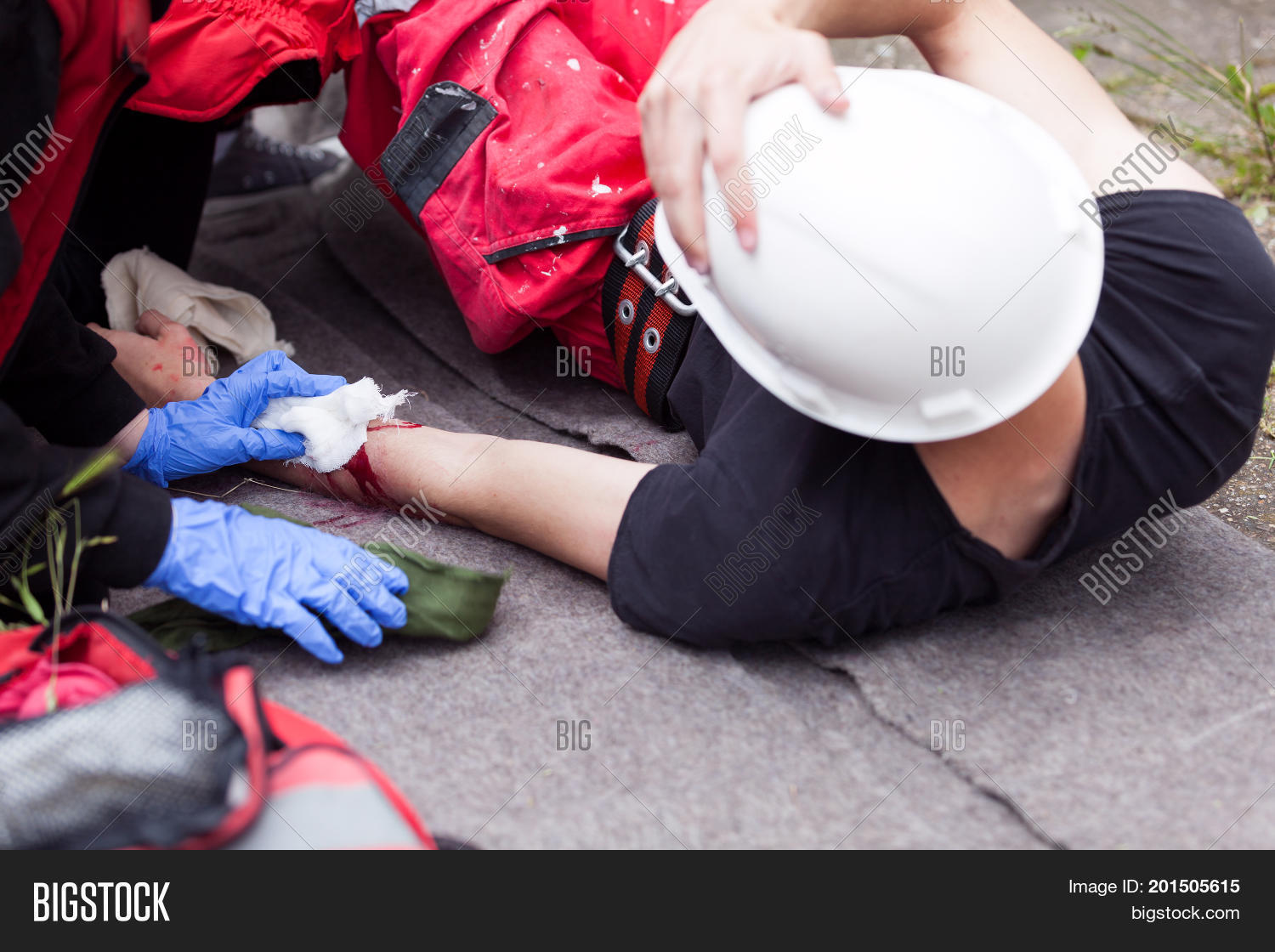 Work Accident. Arm Image & Photo (Free Trial) | Bigstock