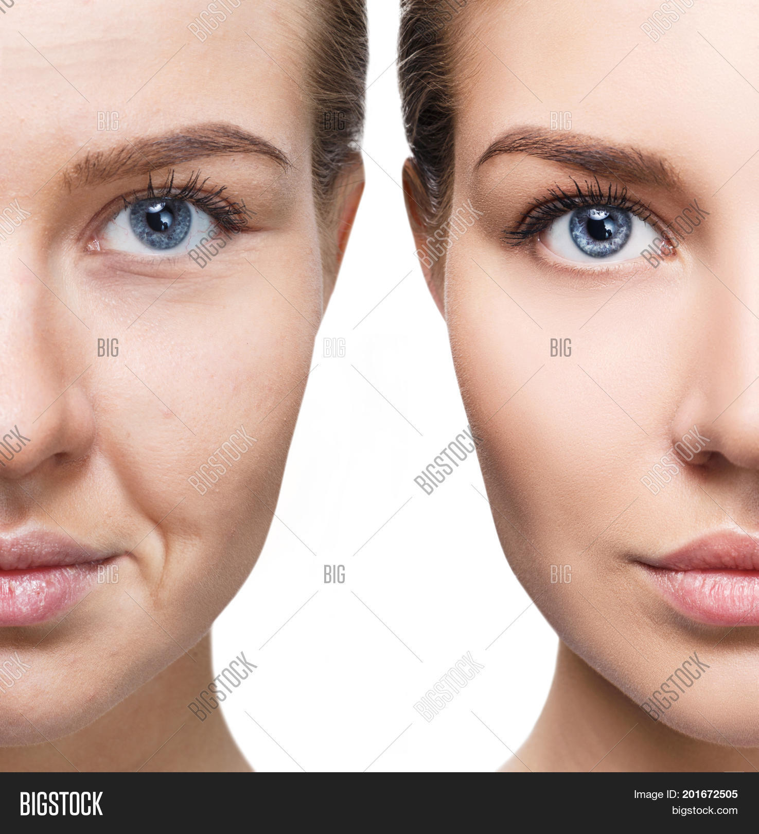 Woman's Face Before Image & Photo (Free Trial) | Bigstock