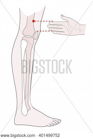 Active Acupuncture Image & Photo (Free Trial) | Bigstock