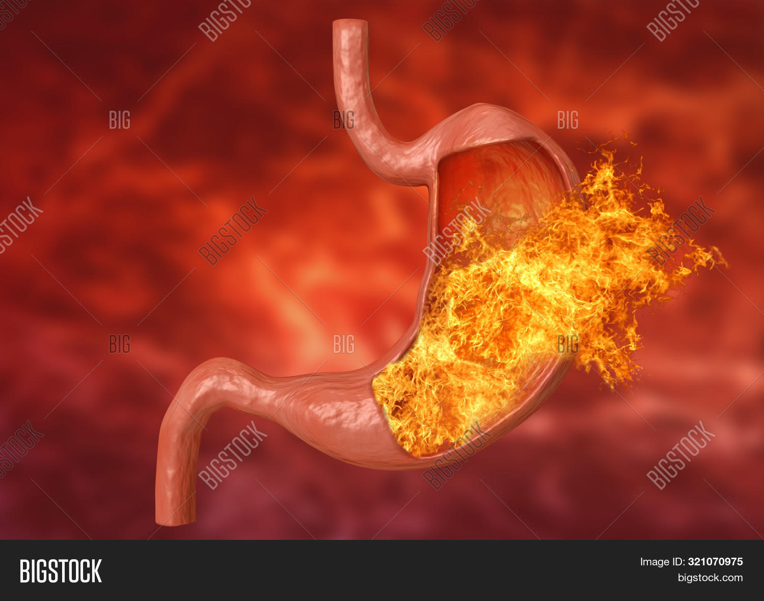 Stomach Fire. Image & Photo (Free Trial) | Bigstock
