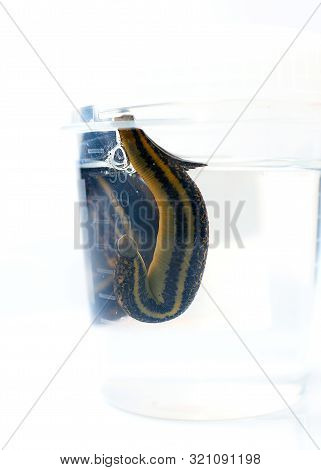 Hirudotherapy. Medical Image & Photo (Free Trial) | Bigstock