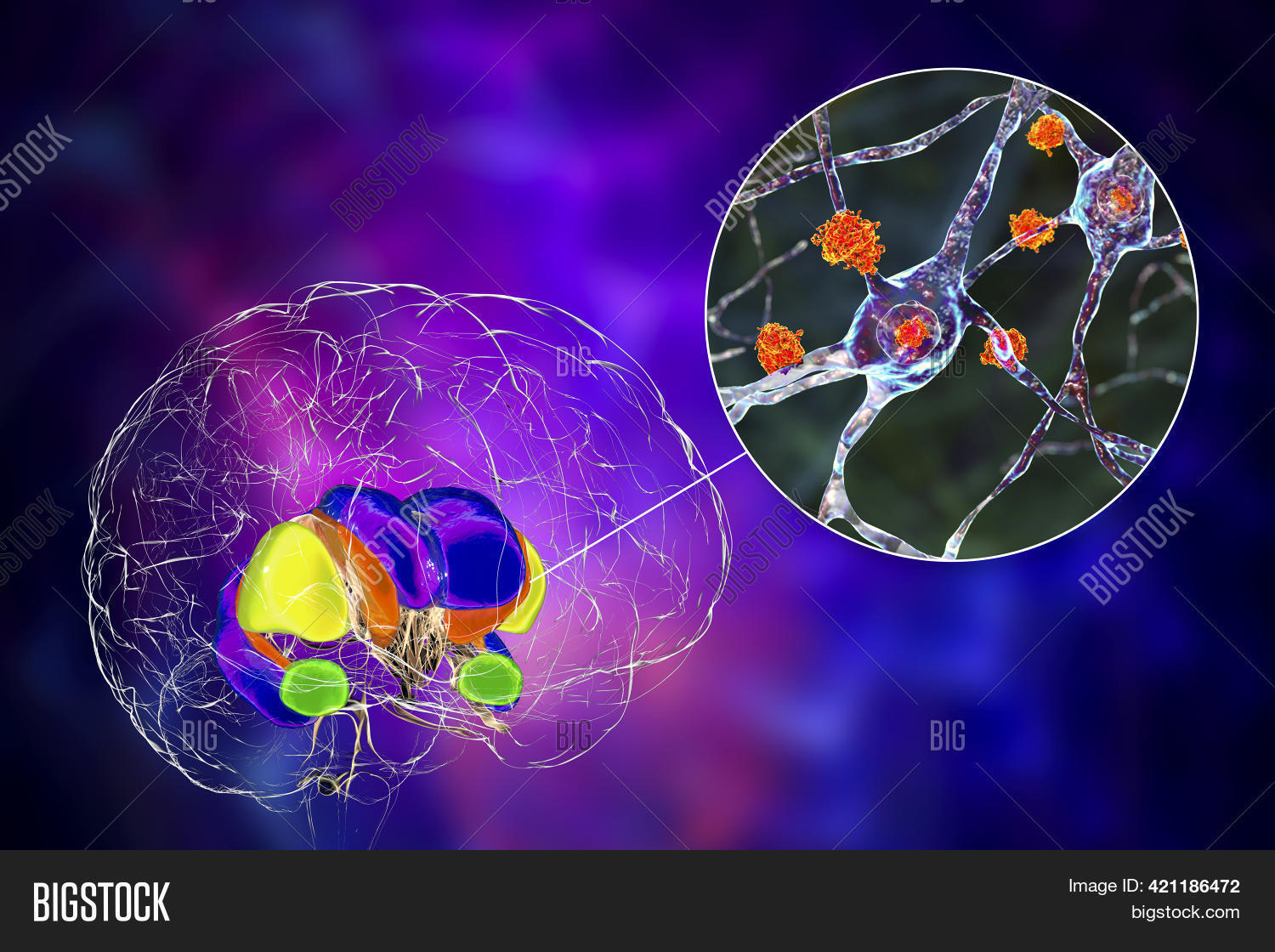 Dorsal Striatum Image & Photo (Free Trial) | Bigstock